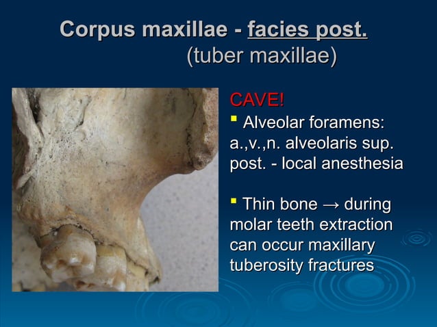 Seminar 3 Anatomy of Maxilla, growth blood supply | PPT | Bone and ...