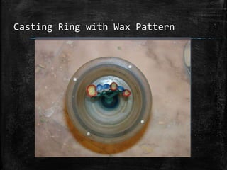 CASTING PROCEDURES AND DEFECTS | PPTX