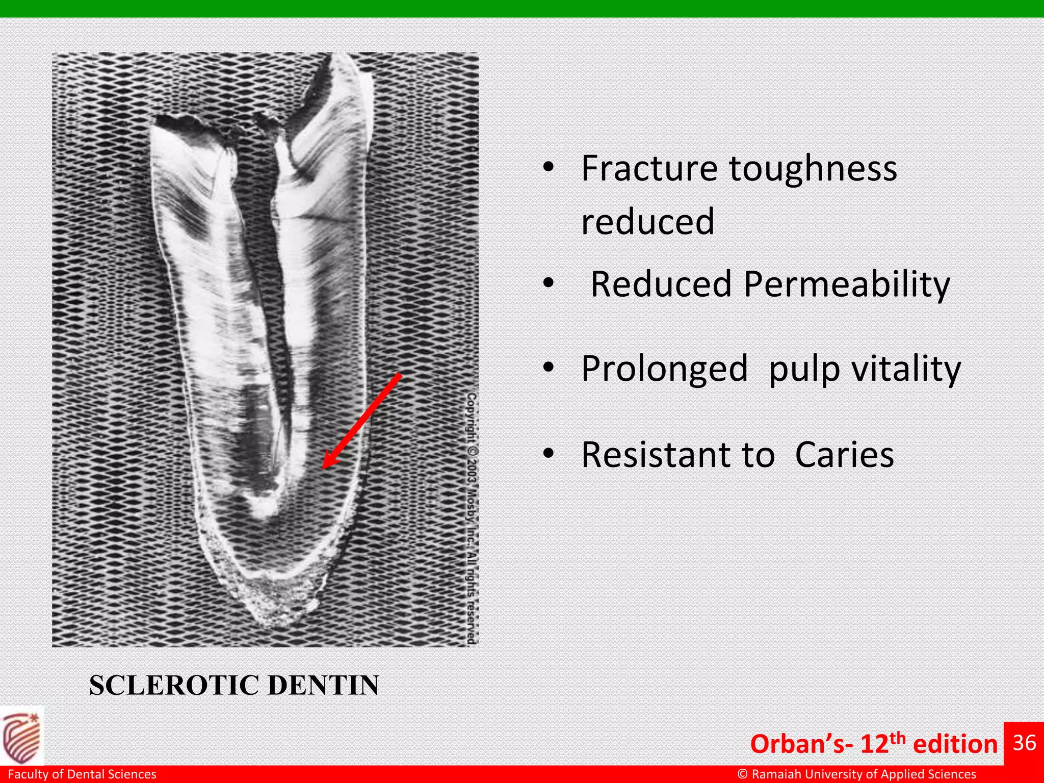 Pathophysiology of caries and pulpal reactions to caries | PPTX