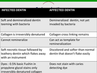 Pathophysiology of caries and pulpal reactions to caries | PPTX