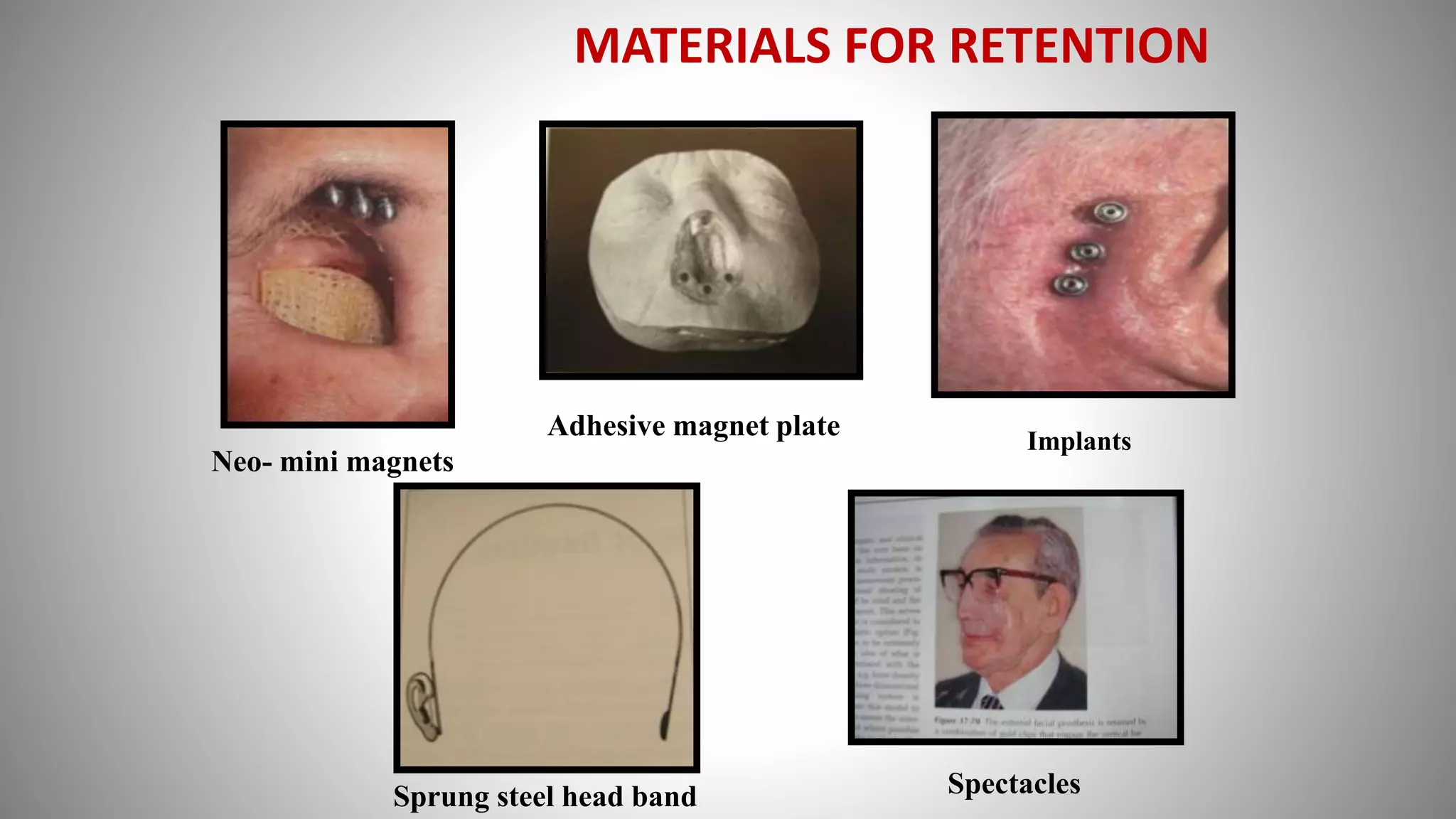 maxillofacial prosthesis materials | PPTX