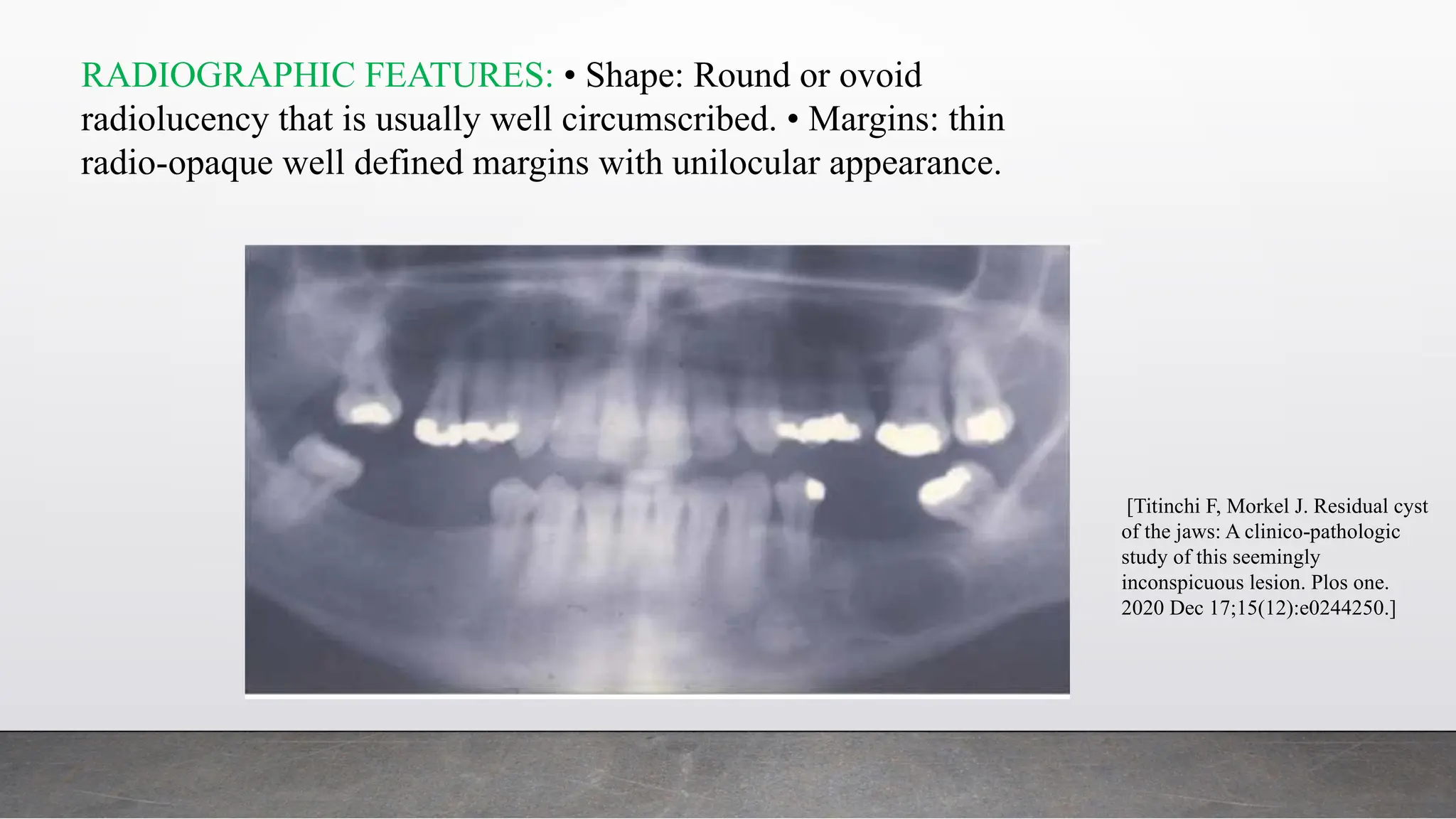Seminar 3 Odontogenic cyst clinical feature , radiography | PPTX