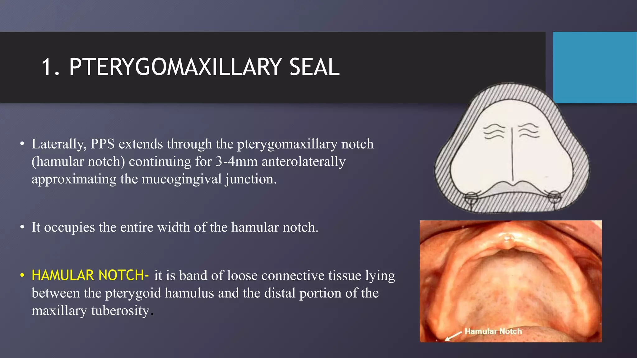 Posterior Palatal Seal Area | PPTX