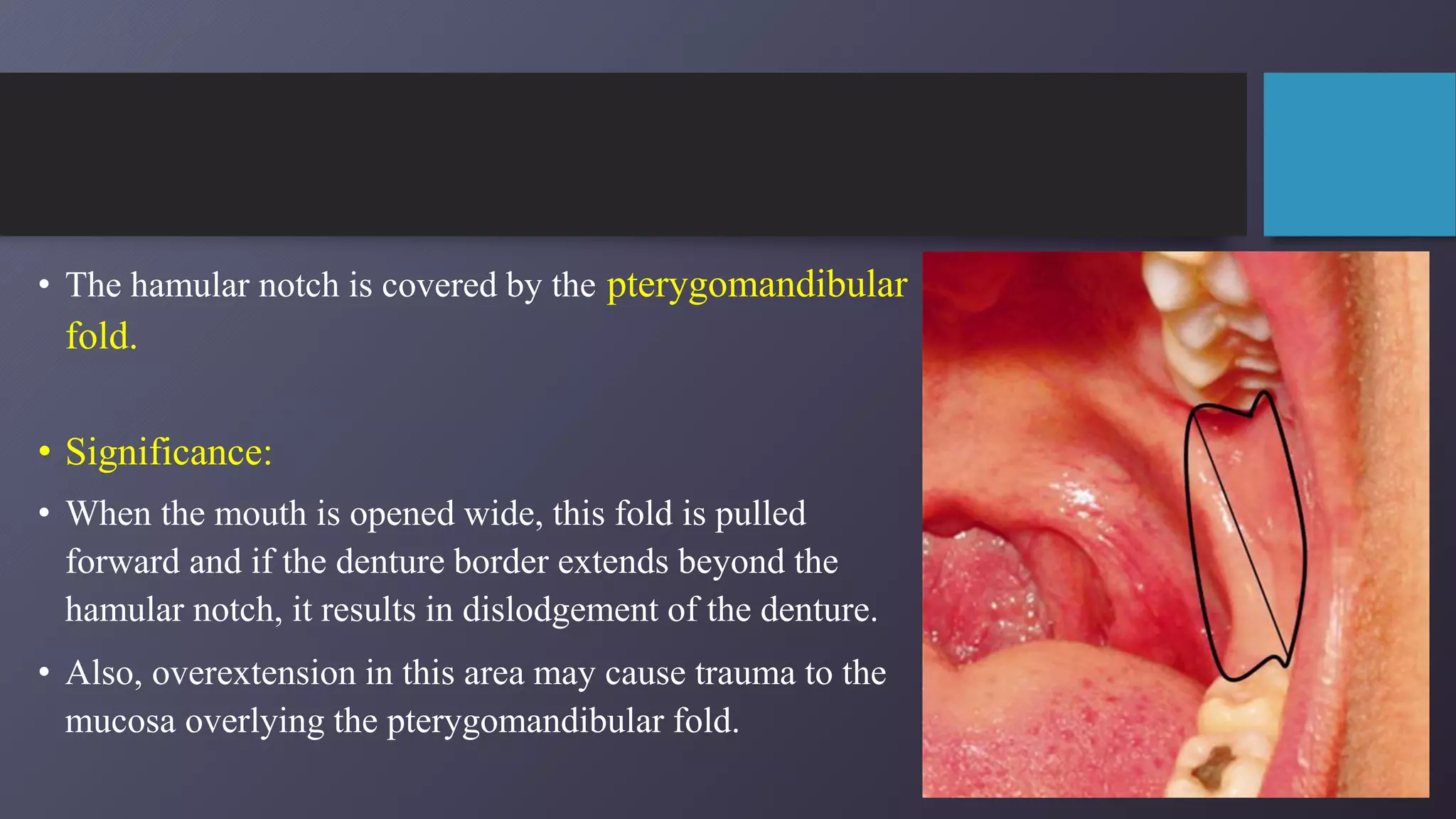 Posterior Palatal Seal Area | PPTX