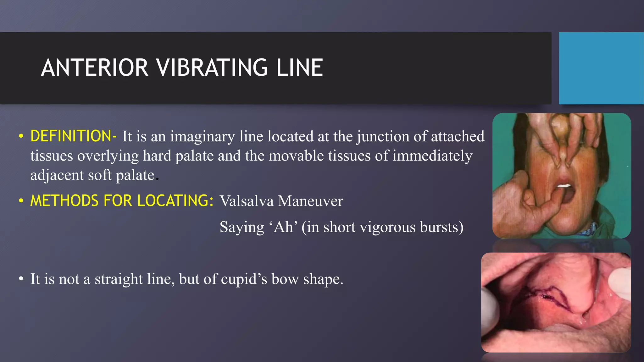 Posterior Palatal Seal Area | PPTX