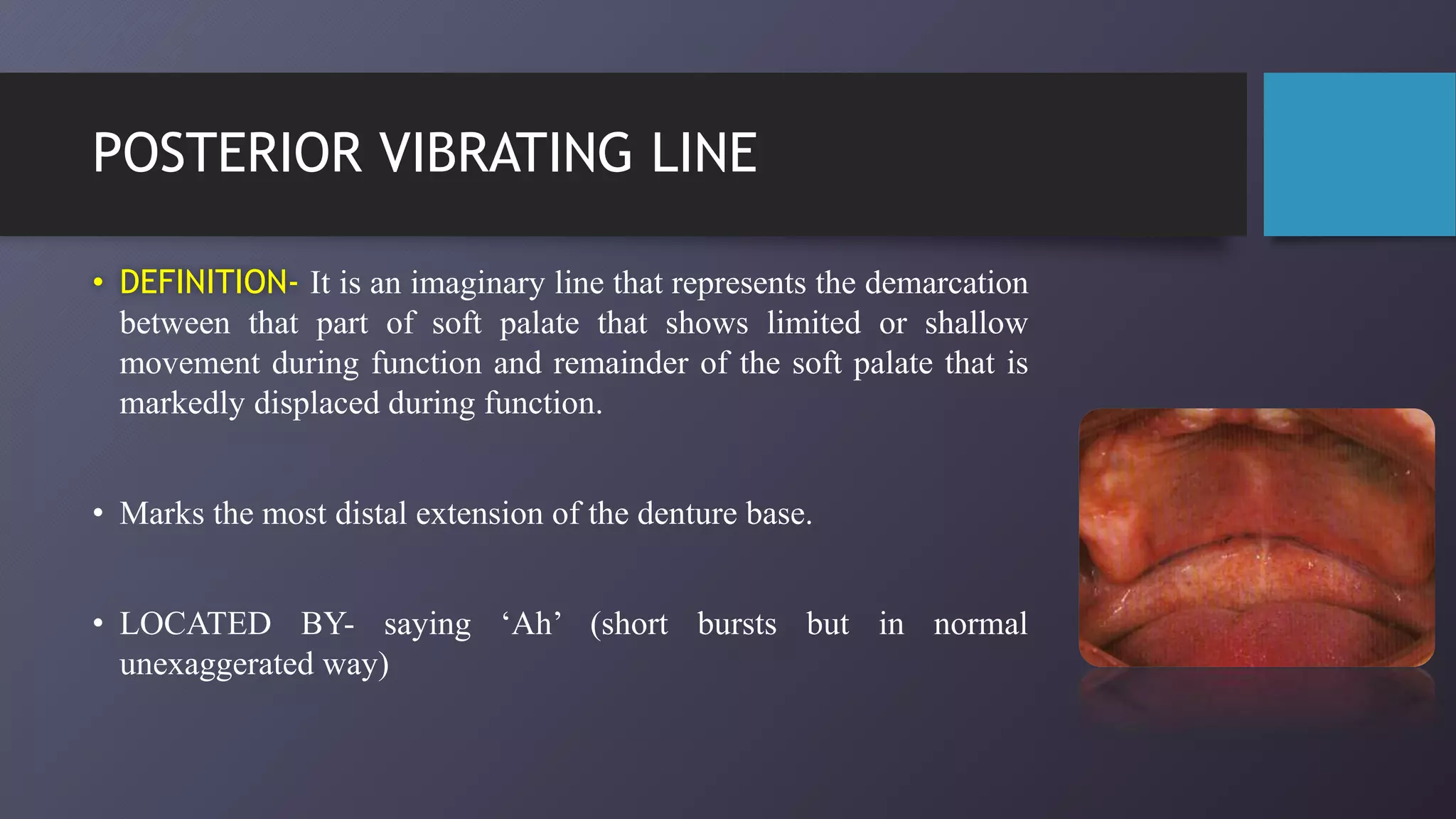 Posterior Palatal Seal Area | PPTX