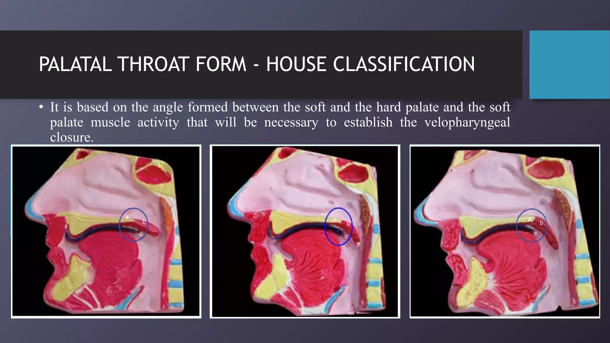 Posterior Palatal Seal Area | PPTX