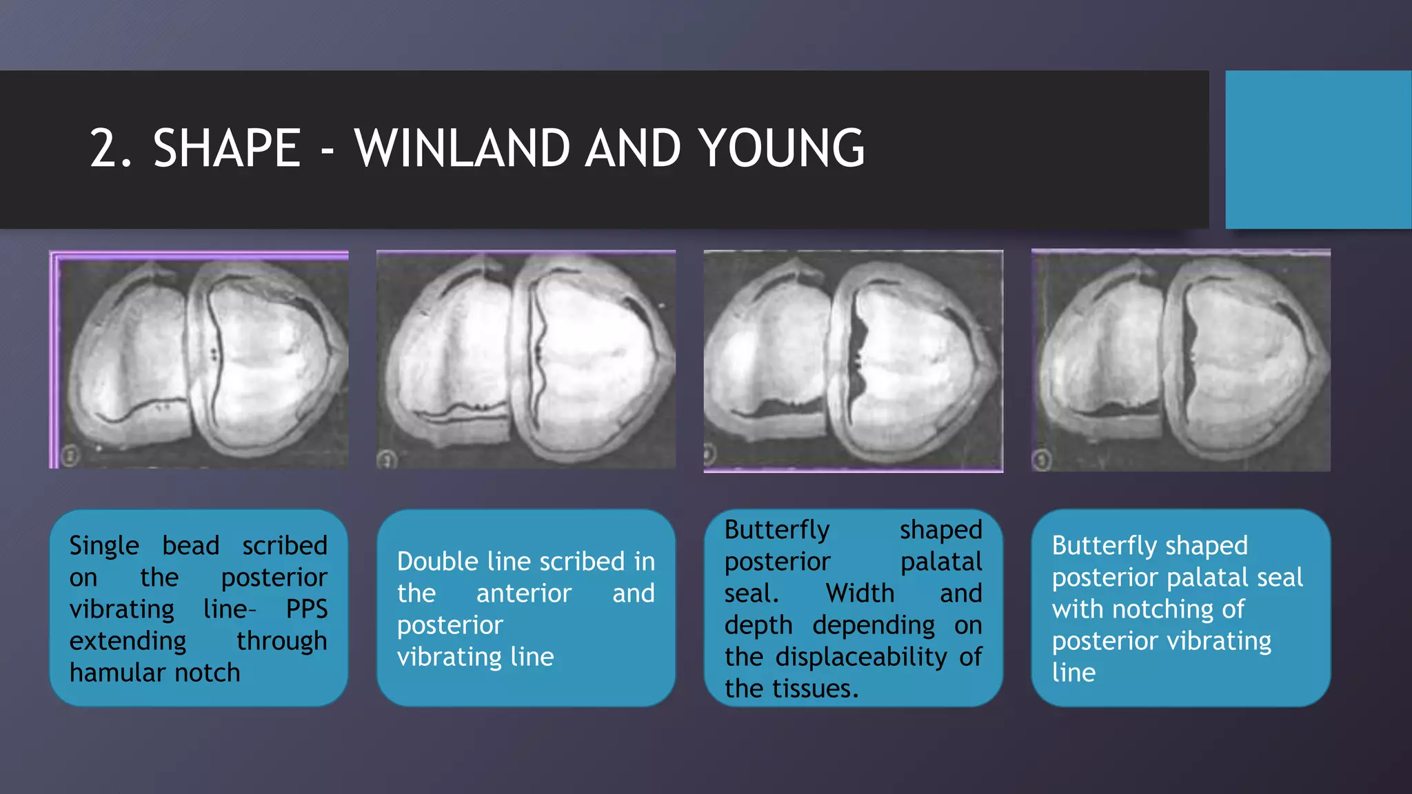 Posterior Palatal Seal Area | PPTX