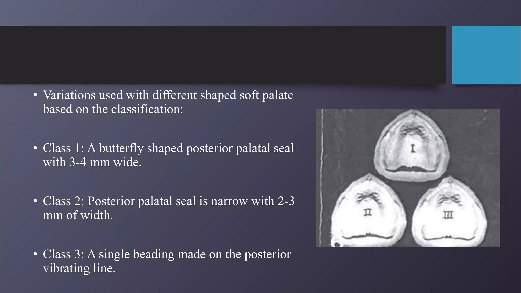 Posterior Palatal Seal Area | PPTX