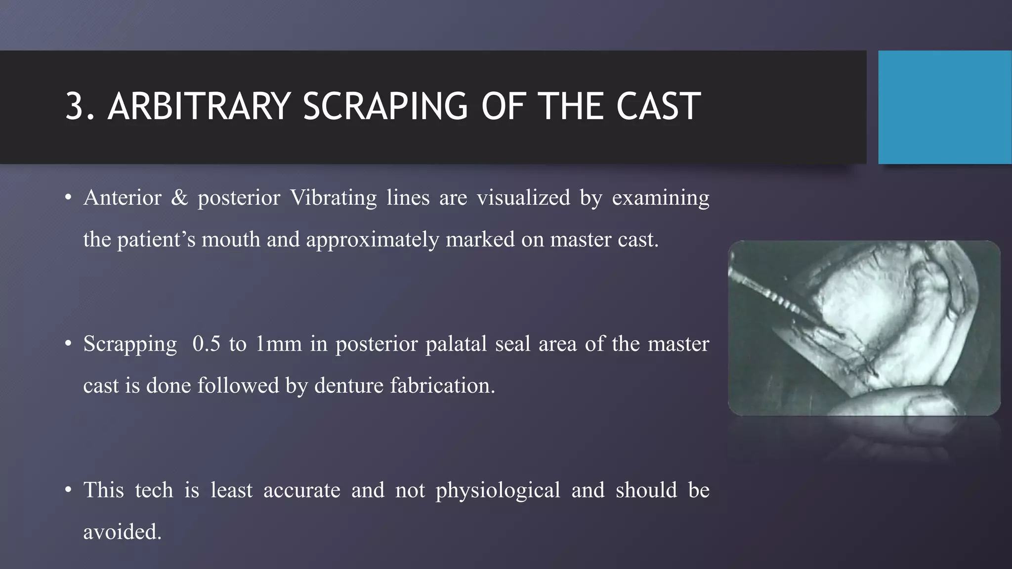 Posterior Palatal Seal Area | PPTX
