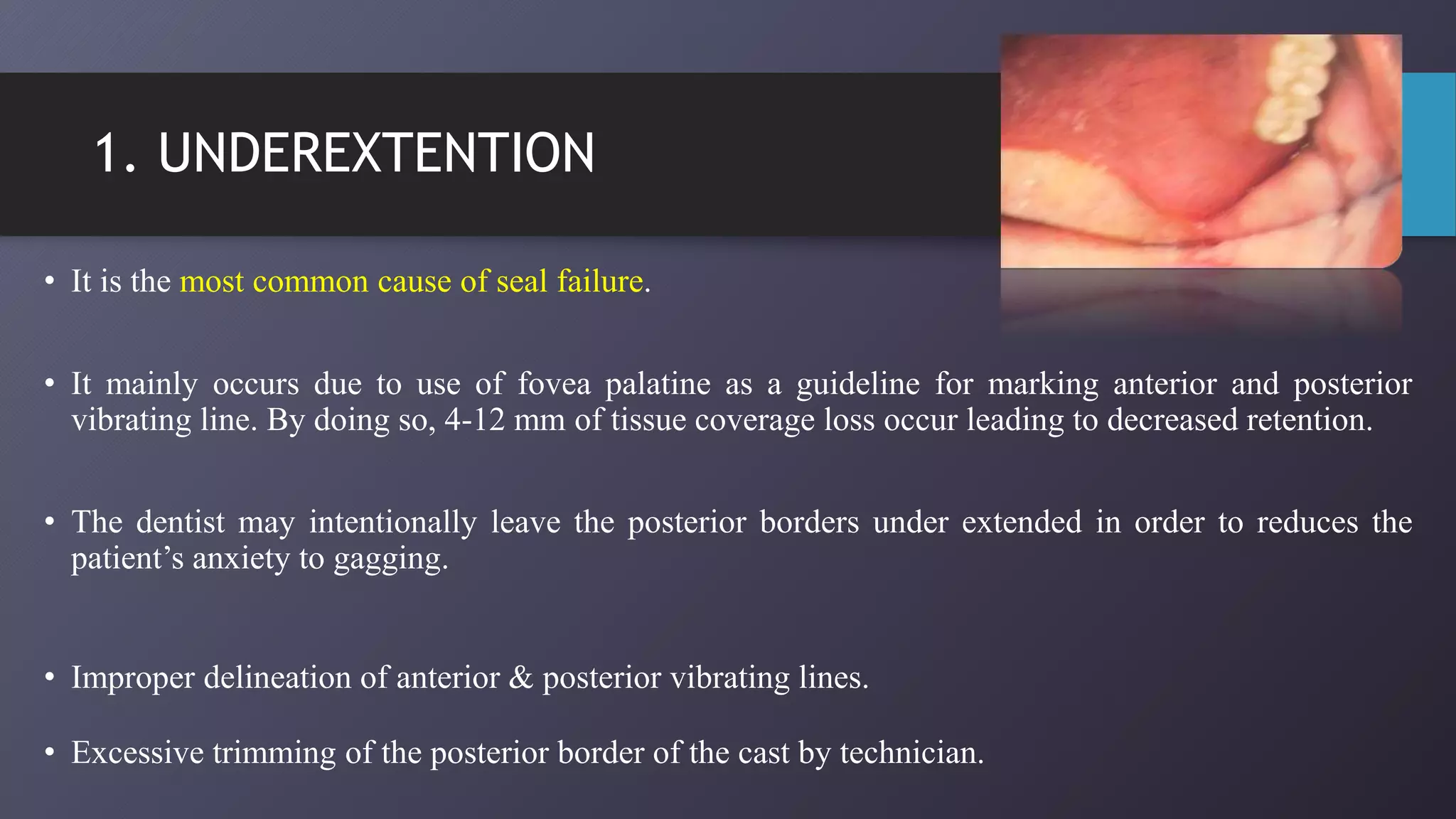 Posterior Palatal Seal Area | PPTX