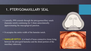 Posterior Palatal Seal Area | PPTX