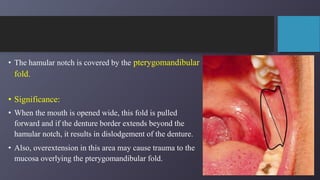 Posterior Palatal Seal Area | PPTX