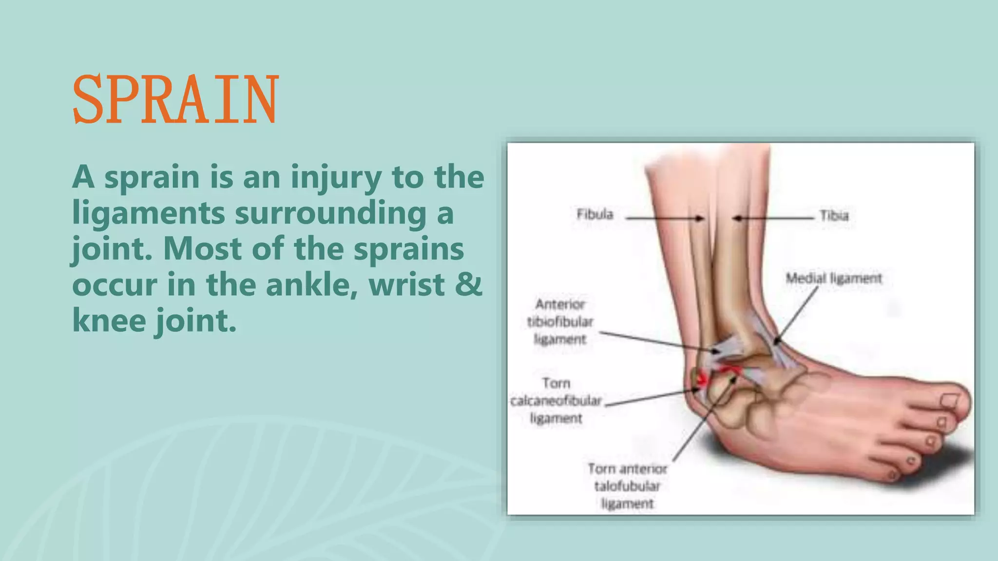 Dislocation,sprain,strain and contusion.pptx