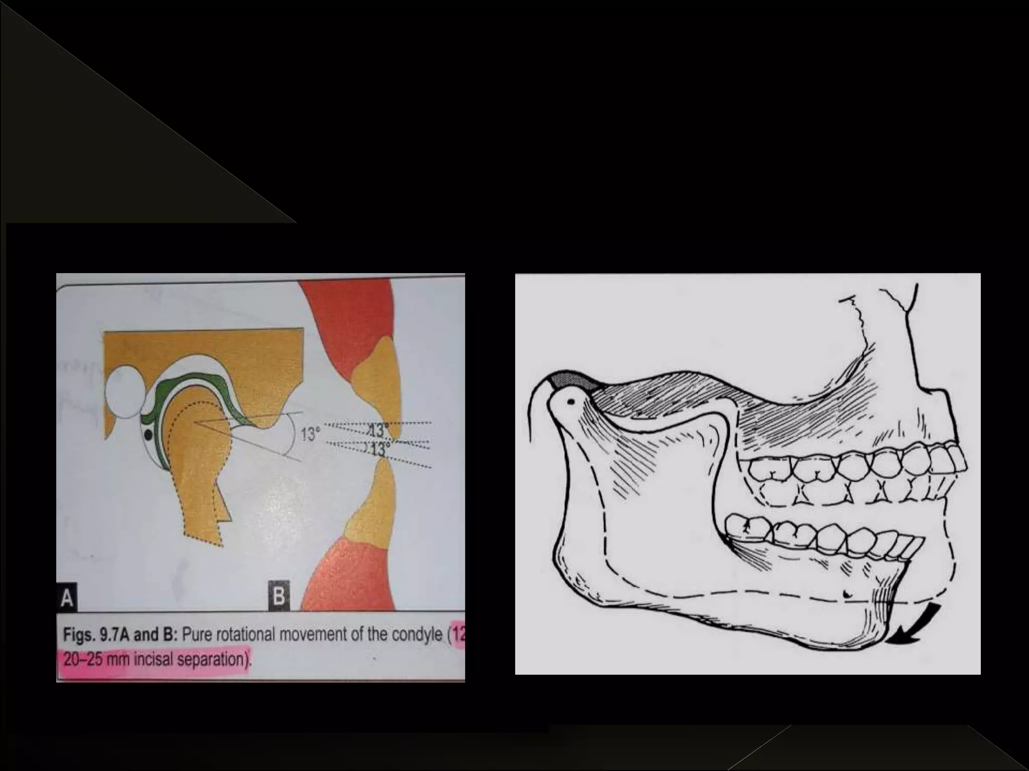 Mandibular movements and determinants | PPTX