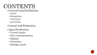 Perforation in Endodontics | PPTX