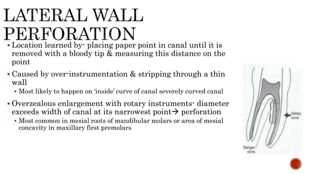 Perforation in Endodontics | PPTX