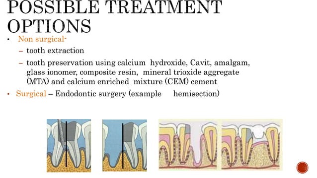 Perforation in Endodontics