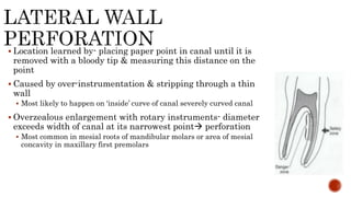 Perforating Canal