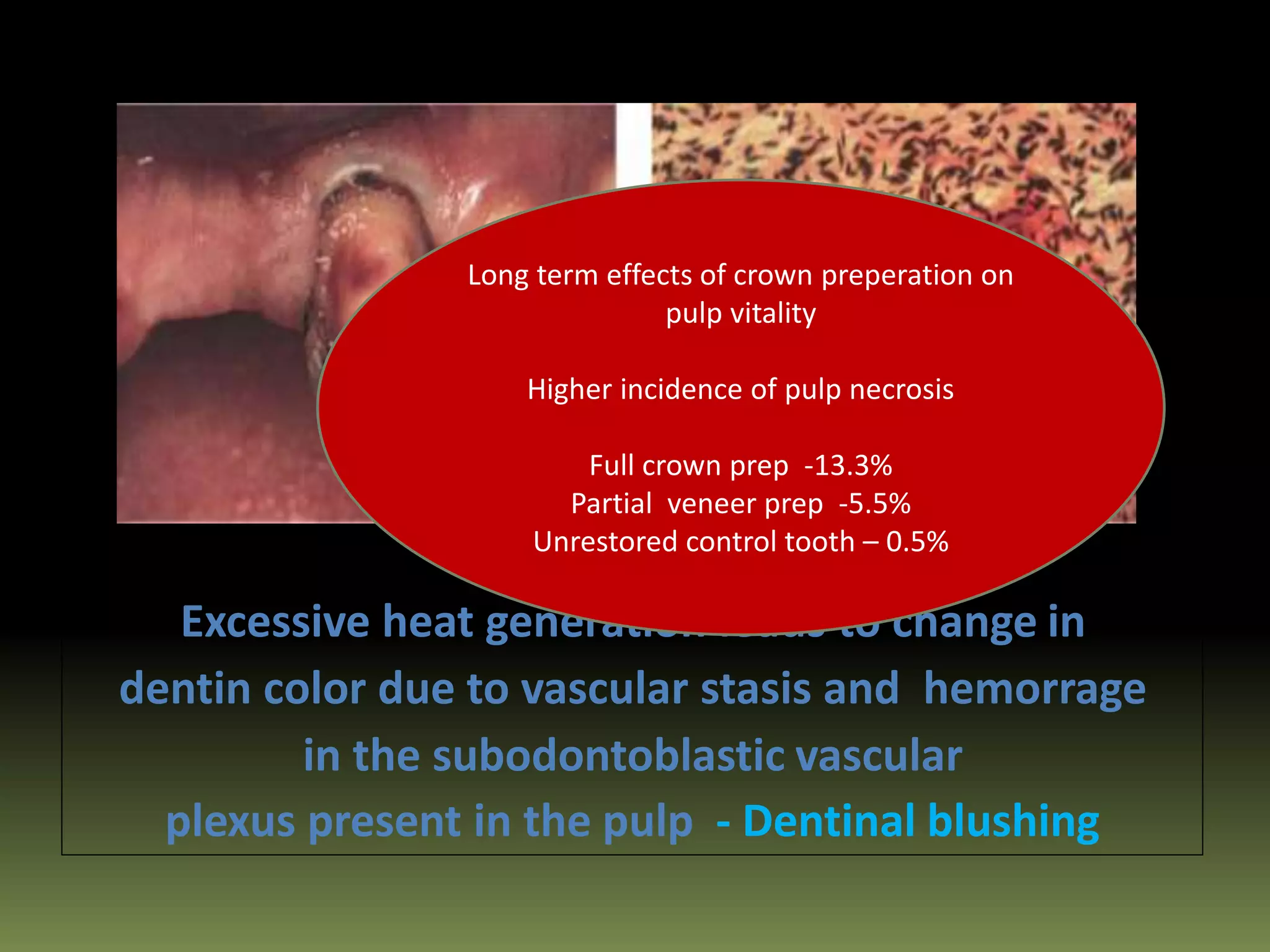 Pulpal response to various dental procedures restorative materials | PPTX