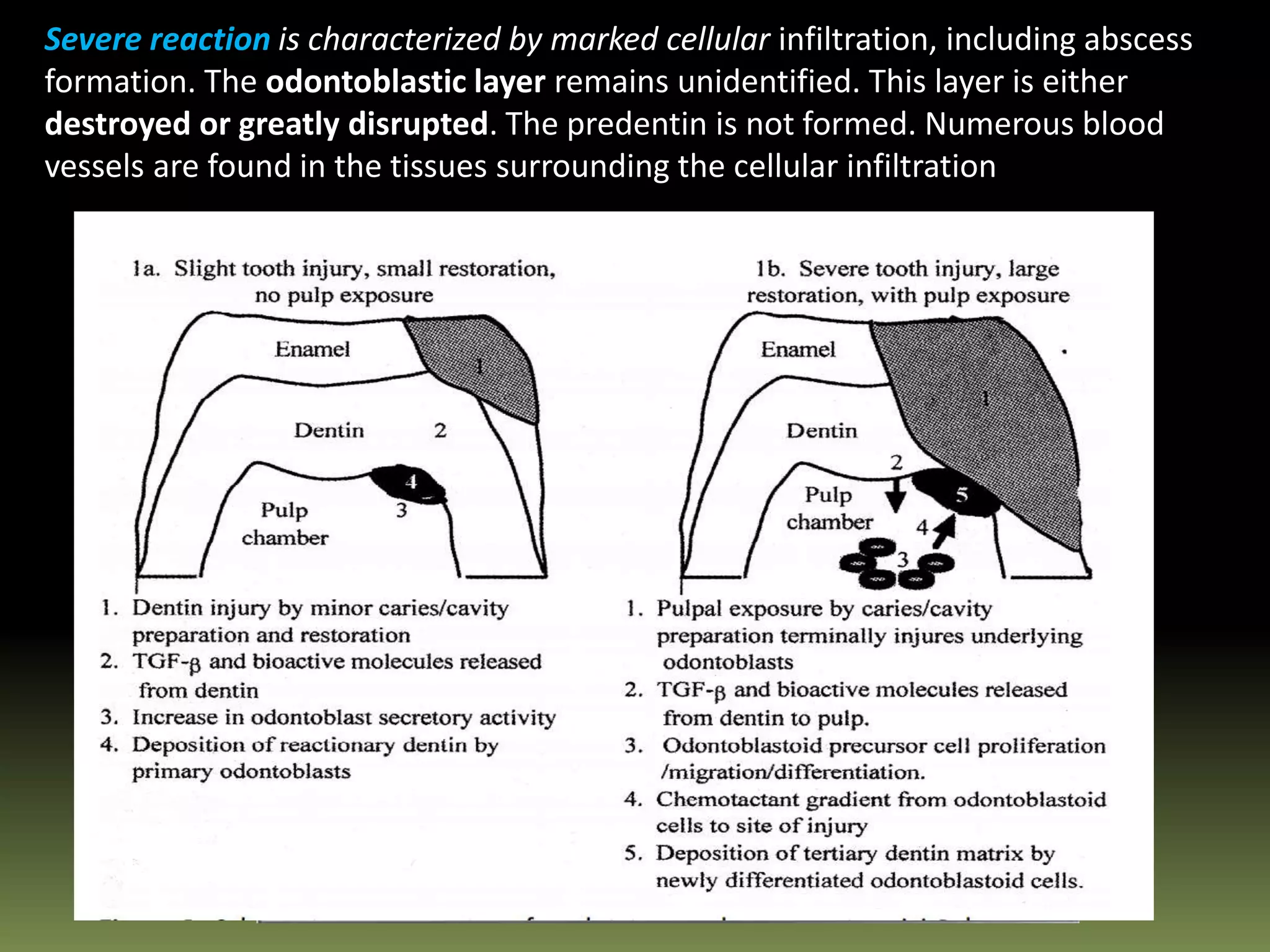 Pulpal response to various dental procedures restorative materials | PPTX