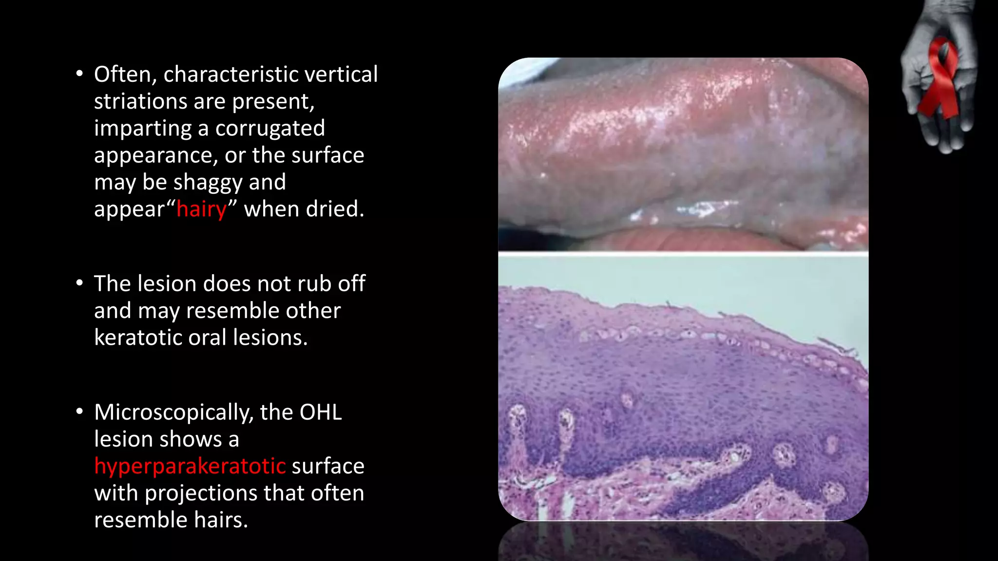 aids and periodontium | PPTX | Dental Health | Diseases and Conditions