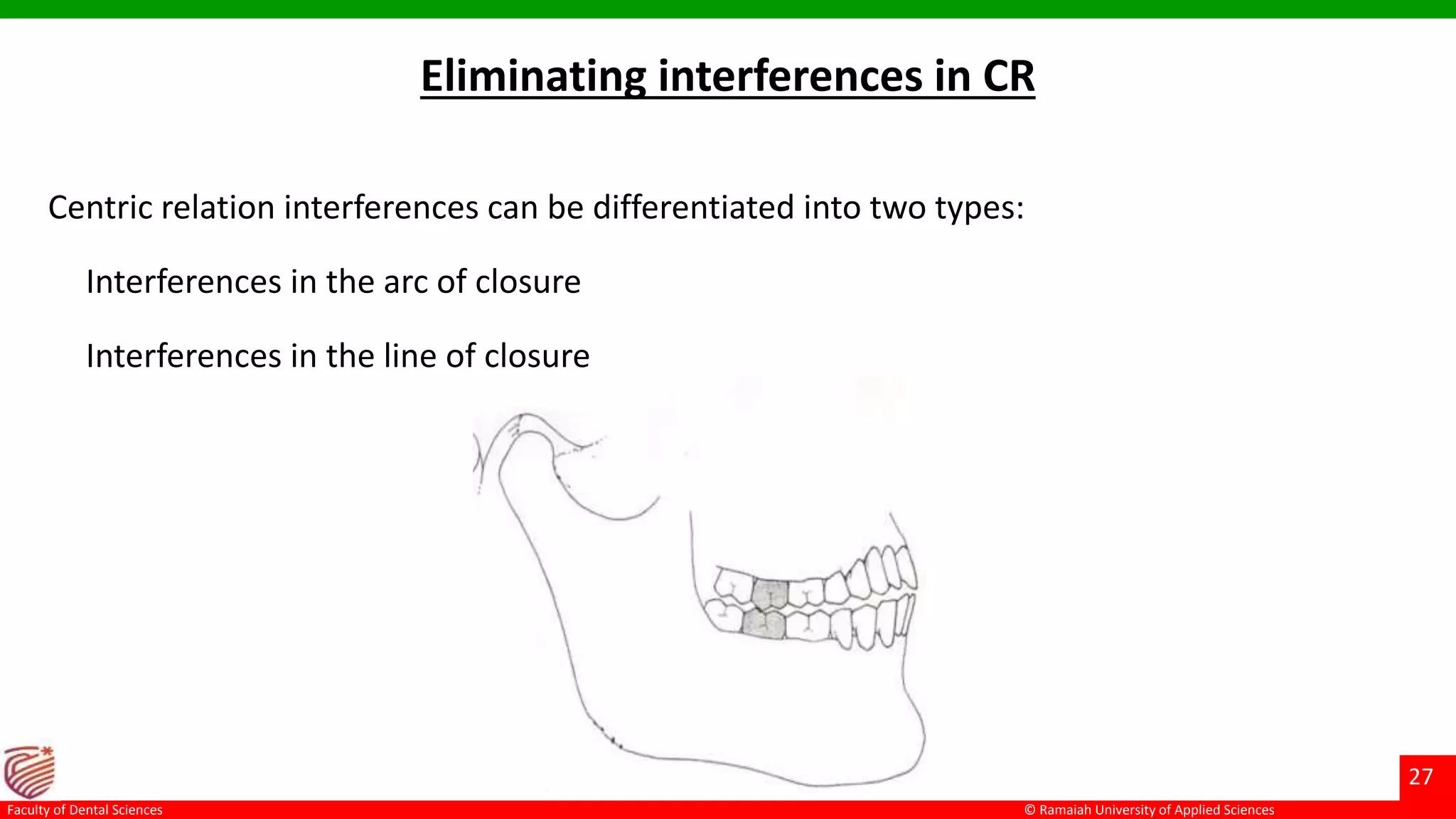 Occlusion in restorative dentistry | PPTX