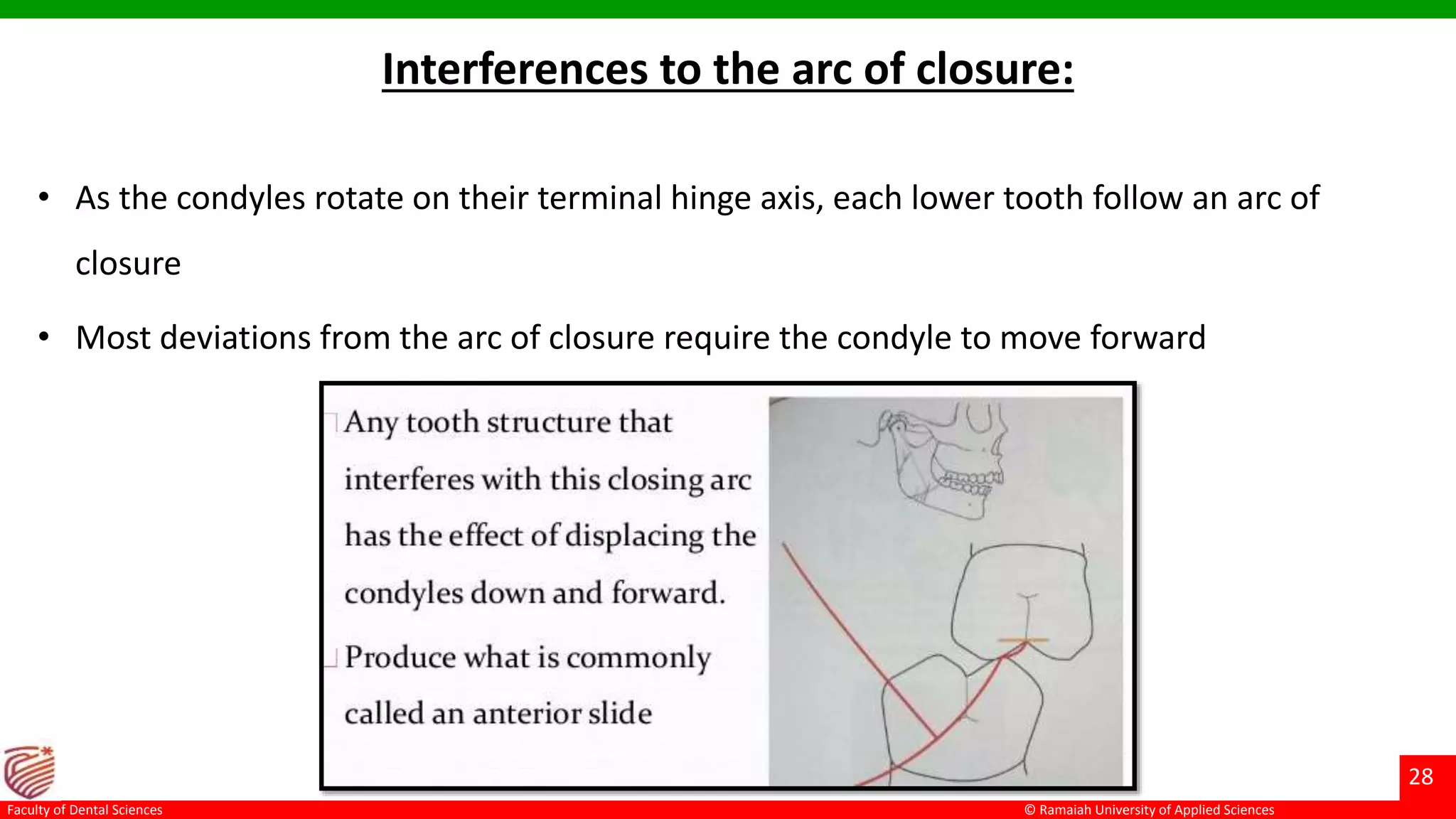 Occlusion in restorative dentistry | PPTX