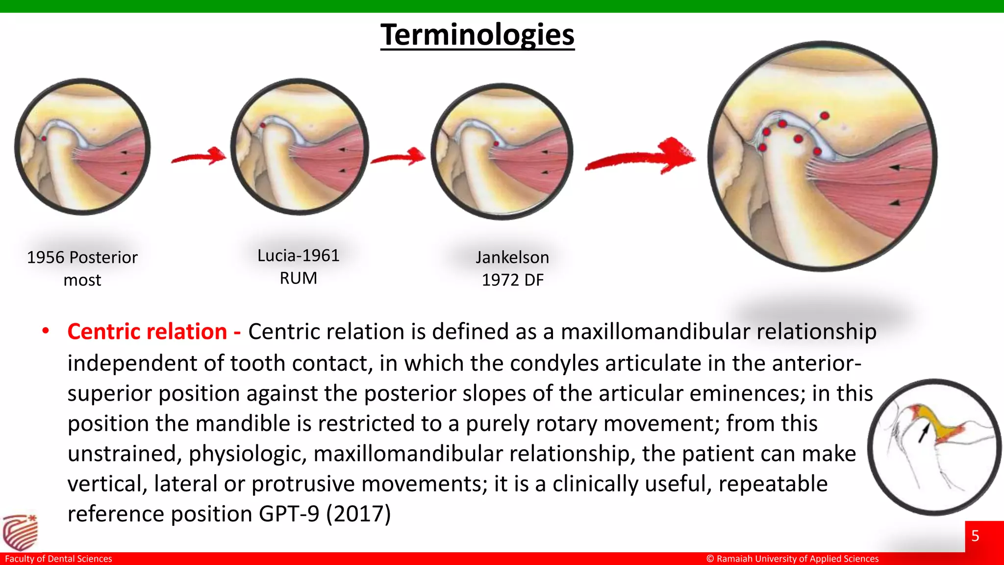 Occlusion in restorative dentistry | PPTX