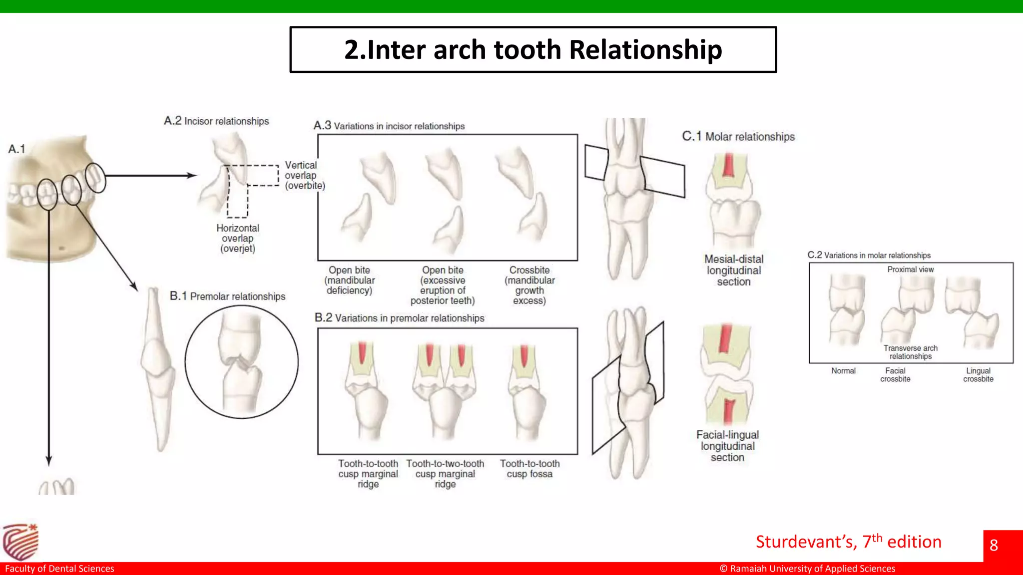 Occlusion in restorative dentistry | PPTX