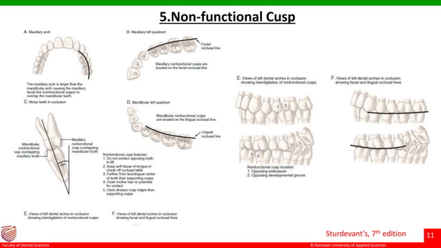 Occlusion in restorative dentistry | PPTX