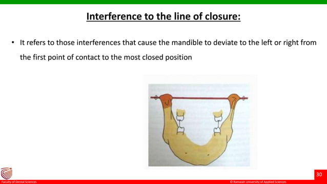 Occlusion in restorative dentistry | PPTX