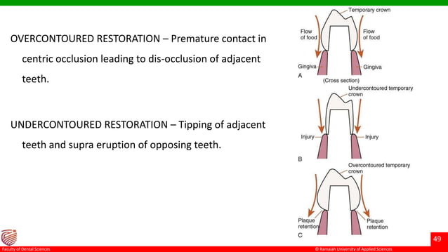 Occlusion in restorative dentistry | PPTX