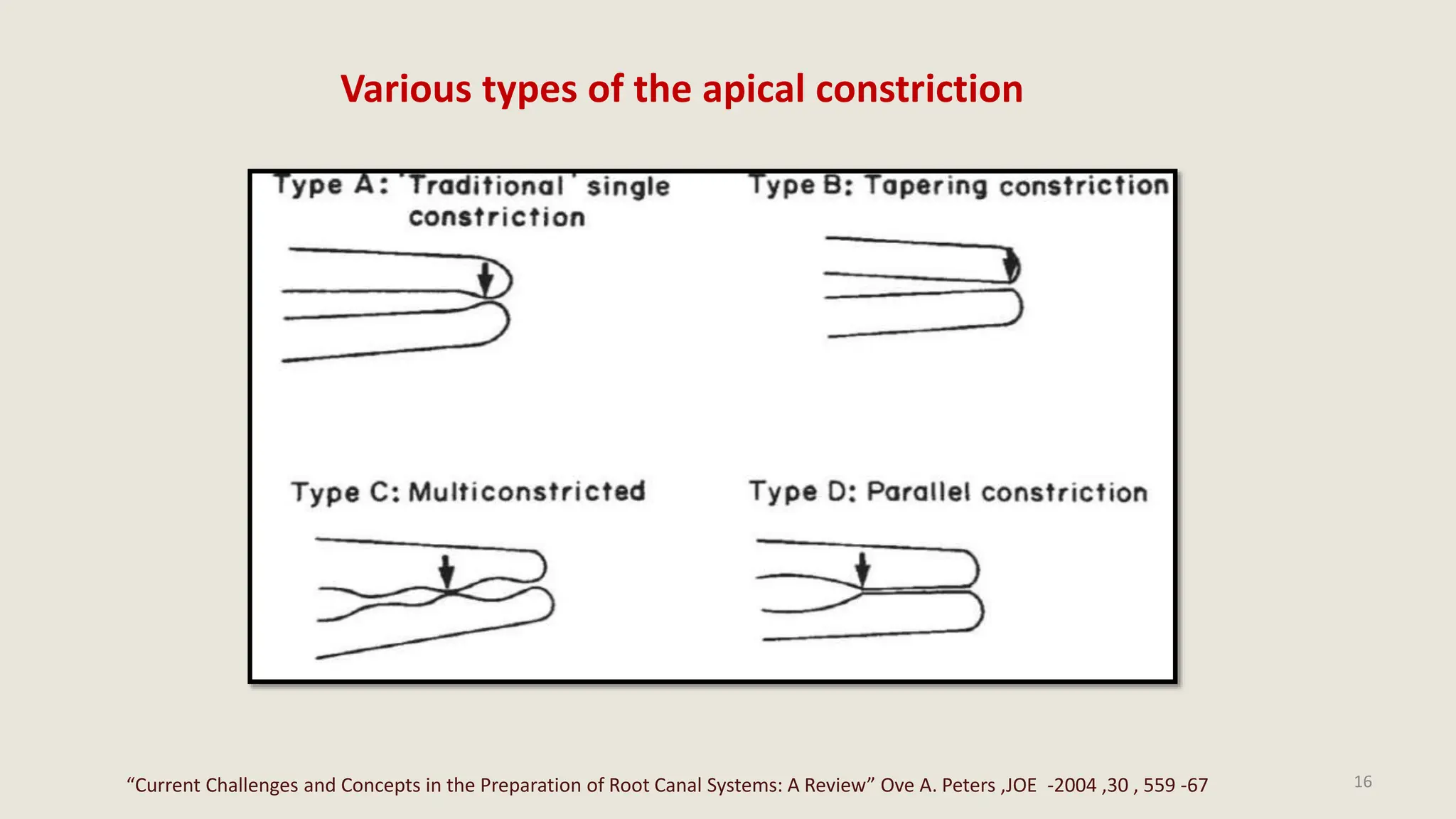 INTERNAL ANATOMY OF PERMANENT TOOTH - Endodontic approaches. | PPTX