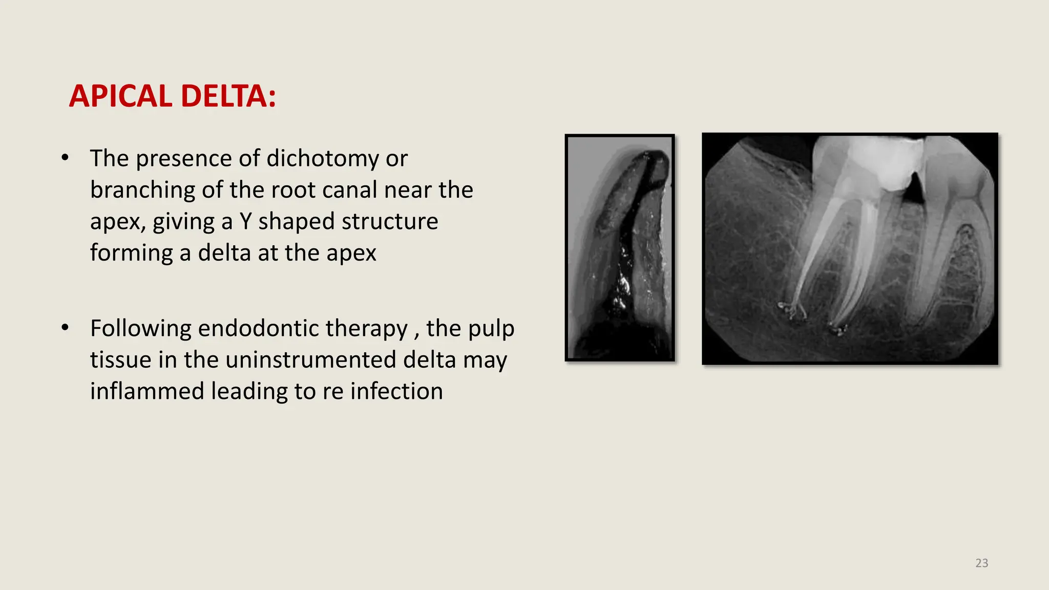 INTERNAL ANATOMY OF PERMANENT TOOTH - Endodontic approaches. | PPTX