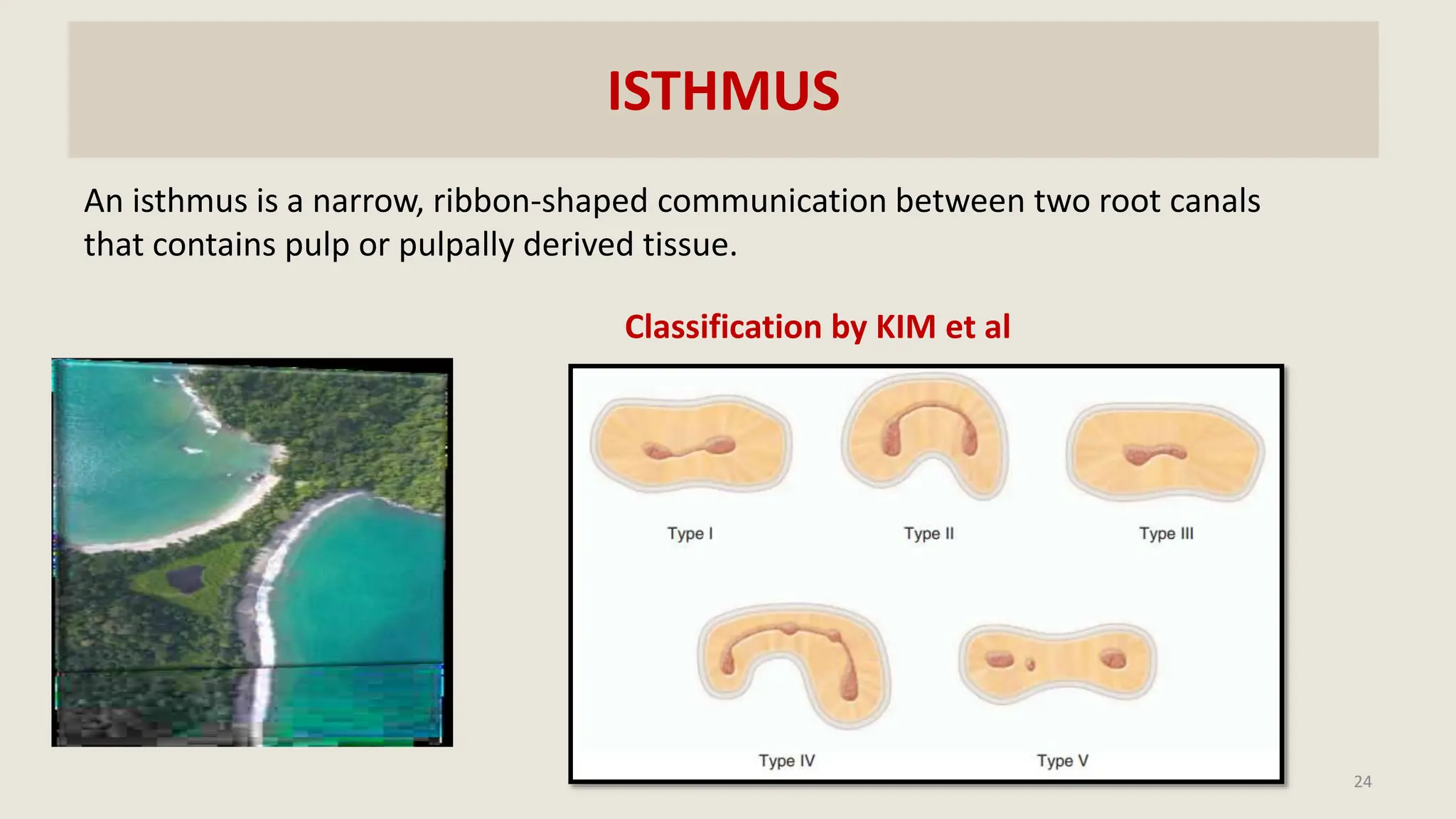 INTERNAL ANATOMY OF PERMANENT TOOTH - Endodontic approaches. | PPTX