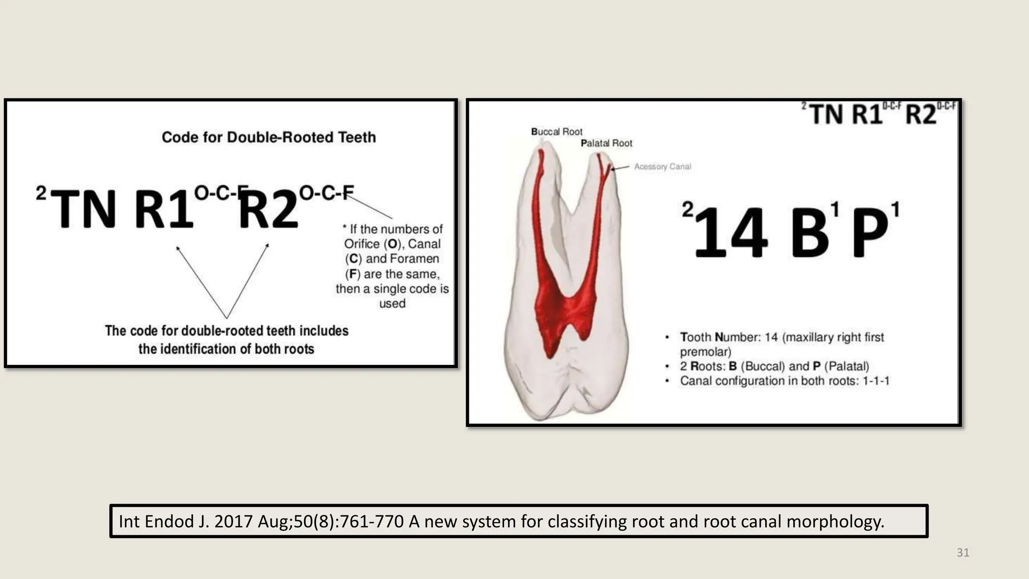 INTERNAL ANATOMY OF PERMANENT TOOTH - Endodontic approaches. | PPTX