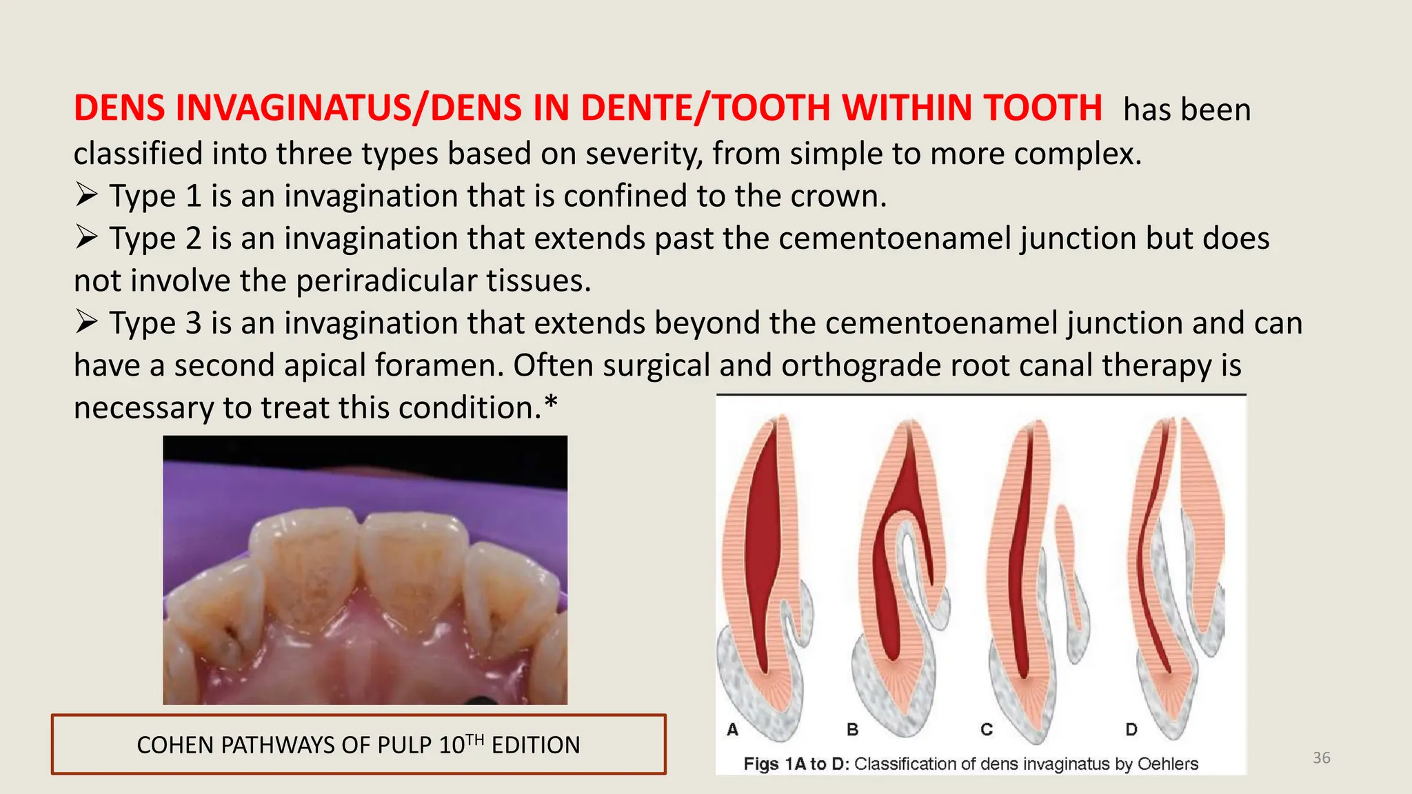 INTERNAL ANATOMY OF PERMANENT TOOTH - Endodontic approaches. | PPTX