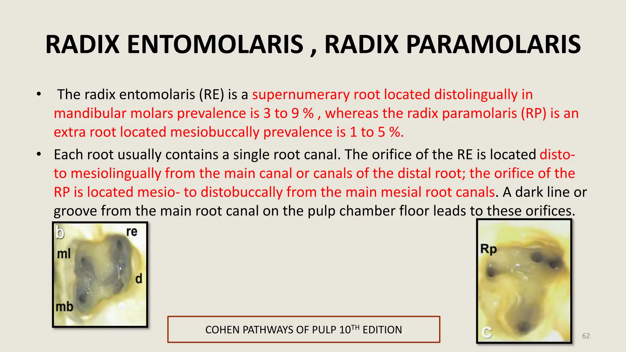 INTERNAL ANATOMY OF PERMANENT TOOTH - Endodontic approaches. | PPTX