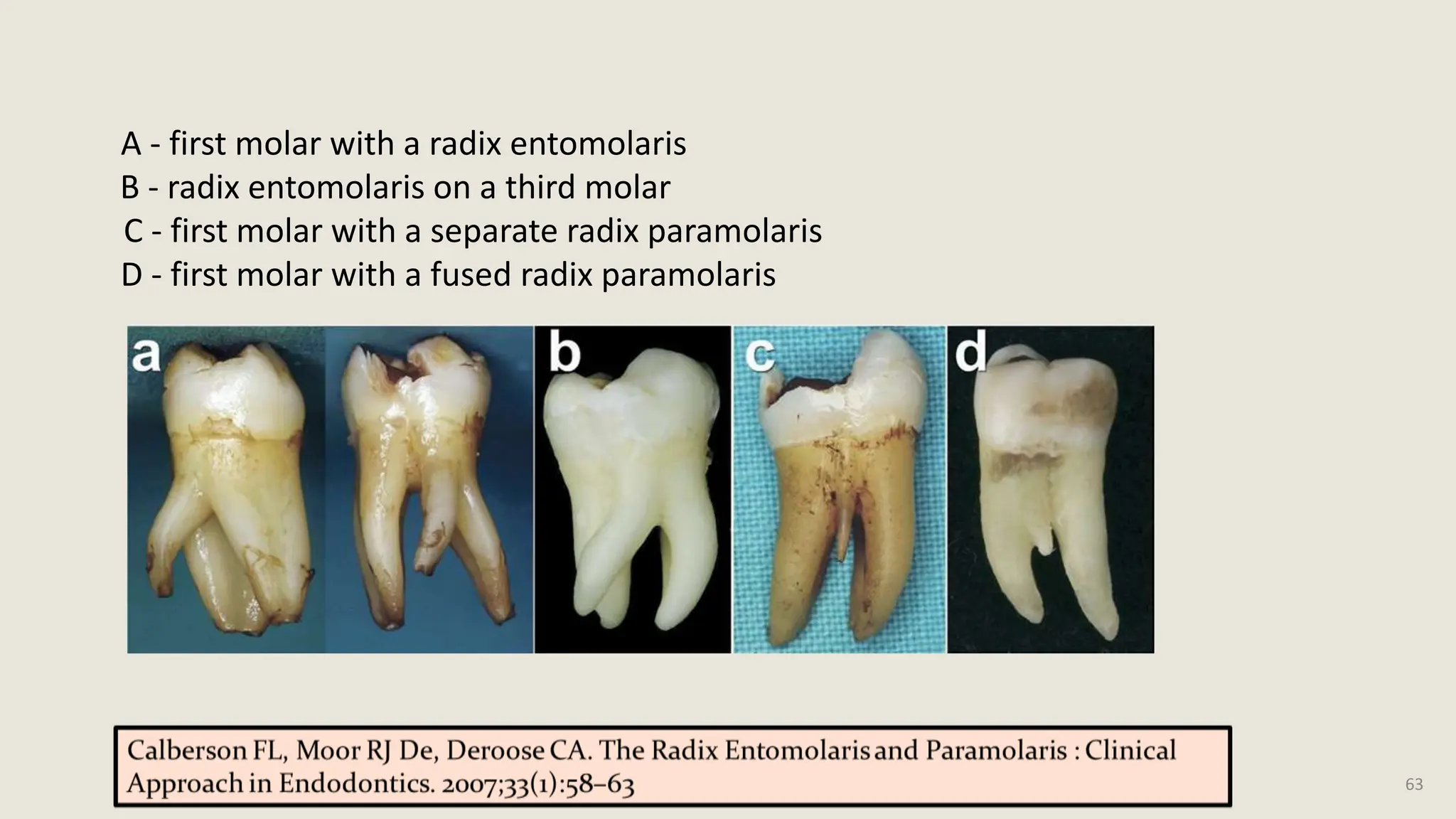 INTERNAL ANATOMY OF PERMANENT TOOTH - Endodontic approaches. | PPTX