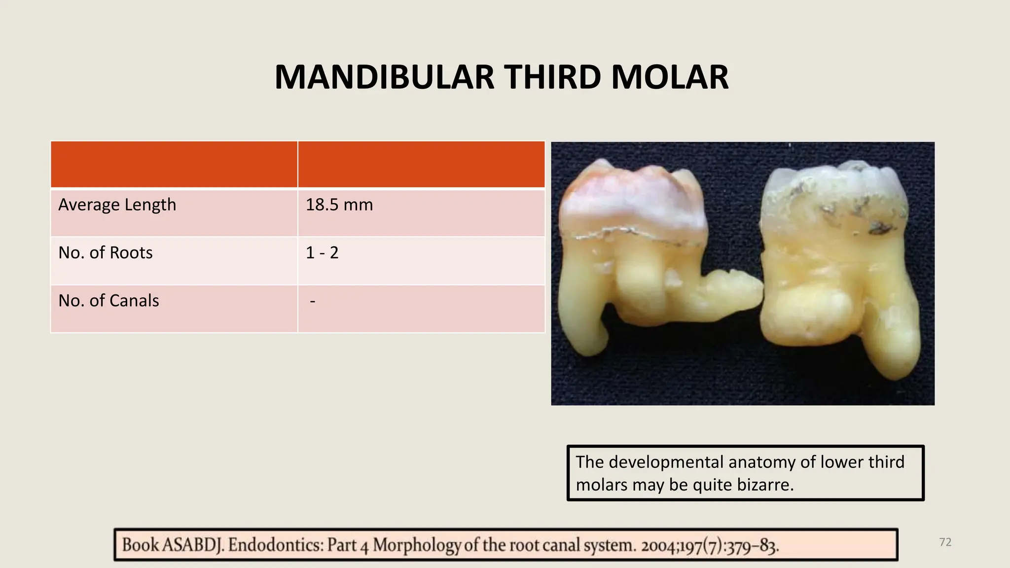 INTERNAL ANATOMY OF PERMANENT TOOTH - Endodontic approaches. | PPTX