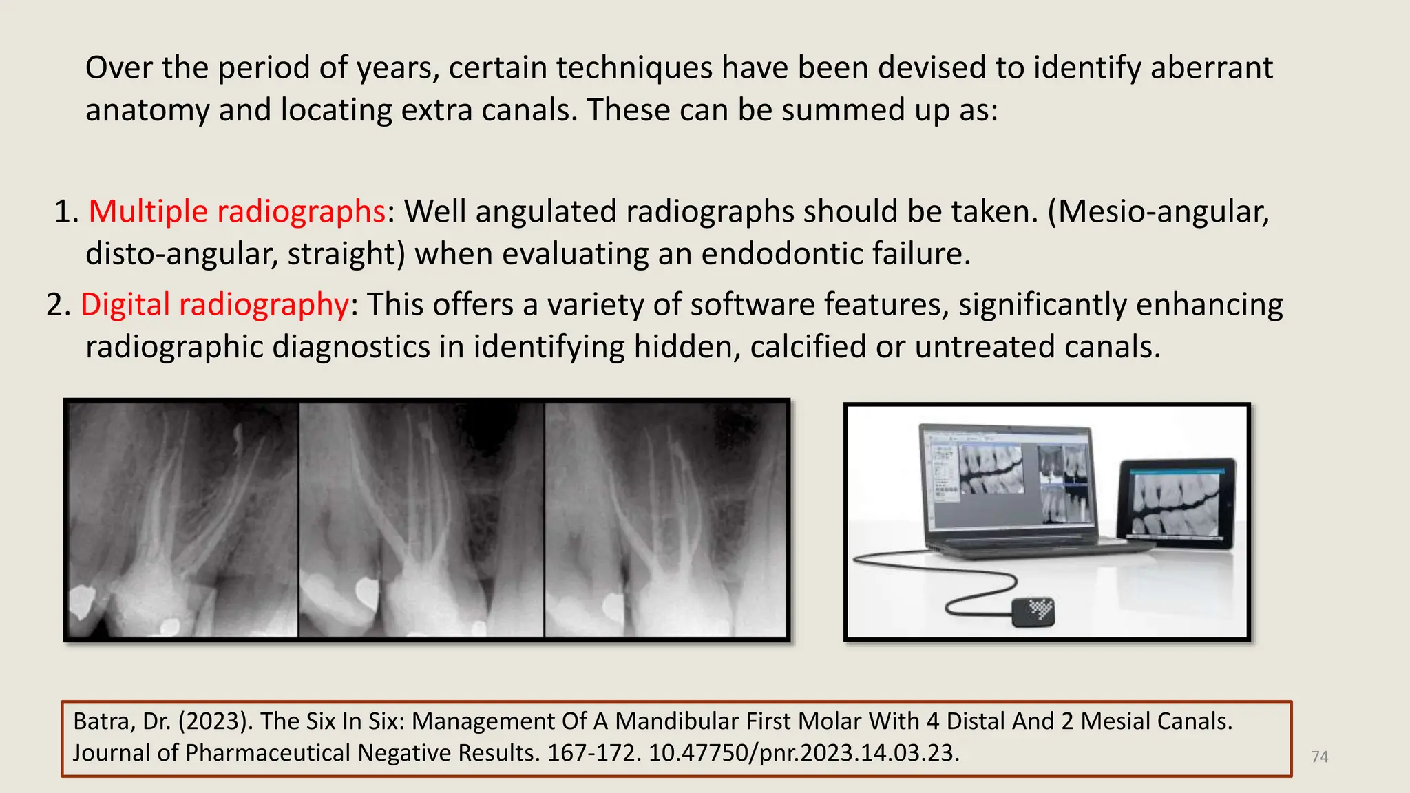 INTERNAL ANATOMY OF PERMANENT TOOTH - Endodontic approaches. | PPTX