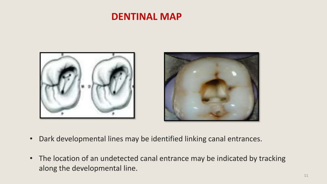 INTERNAL ANATOMY OF PERMANENT TOOTH - Endodontic approaches. | PPTX ...