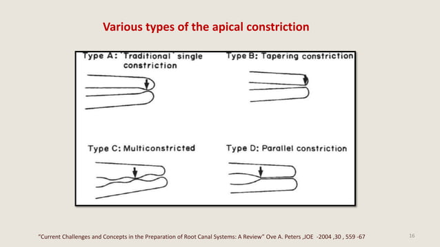 INTERNAL ANATOMY OF PERMANENT TOOTH - Endodontic approaches. | PPTX ...