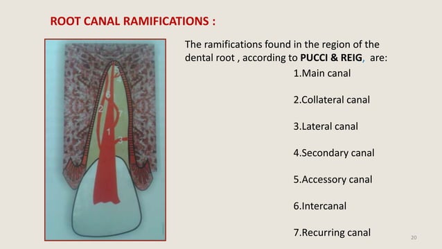 INTERNAL ANATOMY OF PERMANENT TOOTH - Endodontic approaches. | PPTX ...