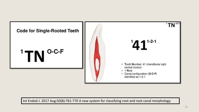 INTERNAL ANATOMY OF PERMANENT TOOTH - Endodontic approaches. | PPTX ...