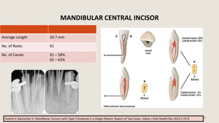 INTERNAL ANATOMY OF PERMANENT TOOTH - Endodontic approaches. | PPTX