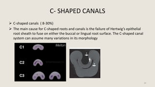 INTERNAL ANATOMY OF PERMANENT TOOTH - Endodontic approaches. | PPTX