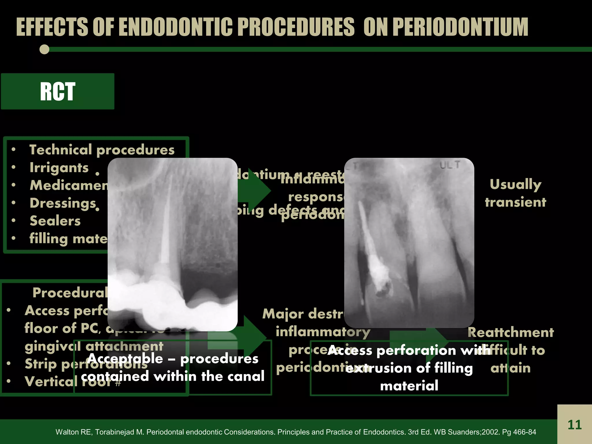 Endodontic Periodontal Relationship, ENDO PERIO LESION | PPTX