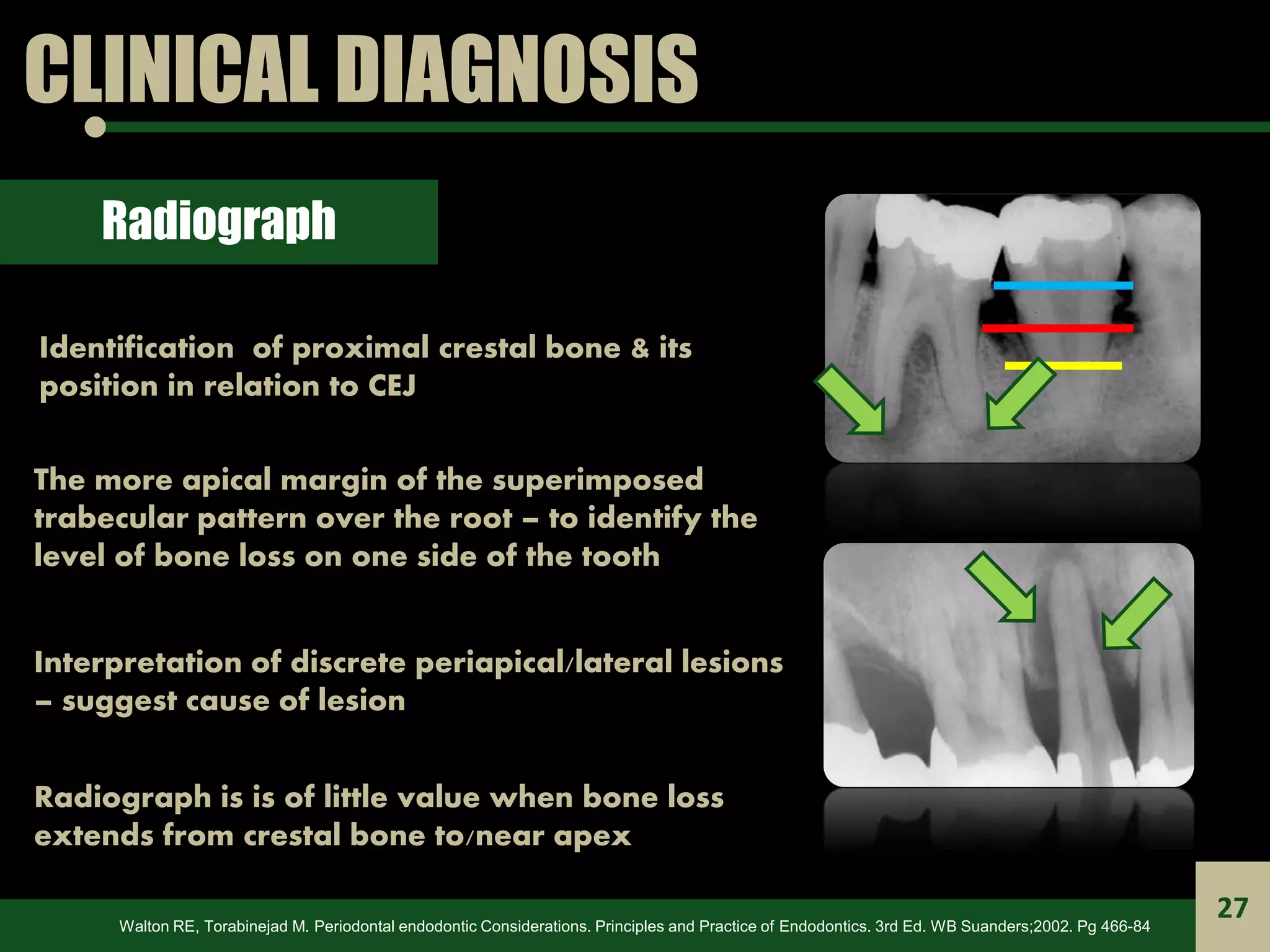 Endodontic Periodontal Relationship, ENDO PERIO LESION | PPTX